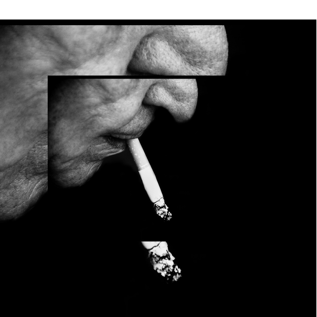 The Ultimate Guide to Smokers Lines Filler | Smoker Lips